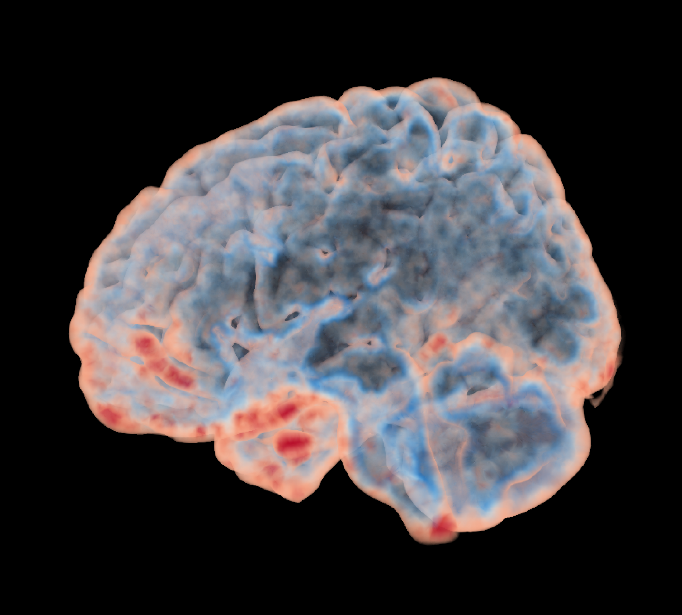 Noisy brains - Fast white noise generation for modelling uncertainty in ...